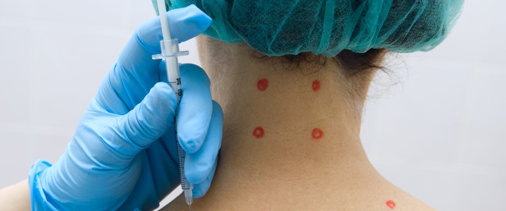 What are Trigger Point Injections Used to Treat?