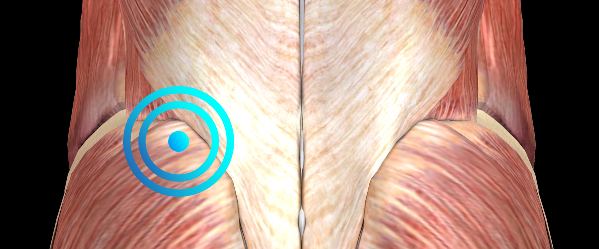 How to Release Trigger Points and Relieve Pain